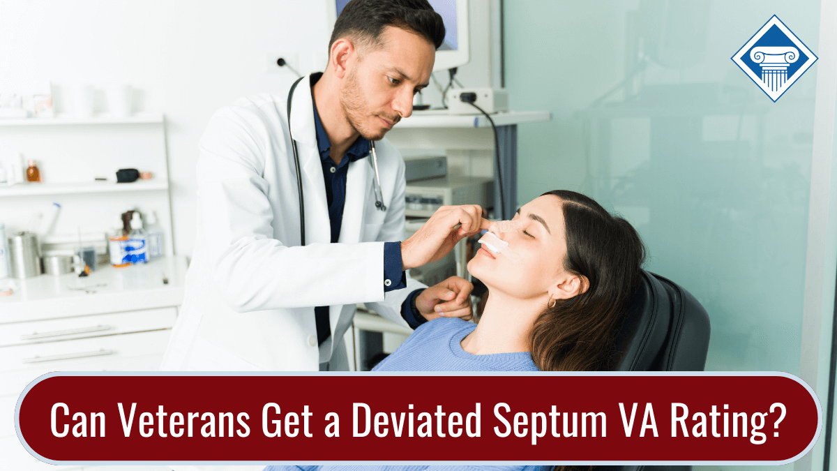 Can veterans get a deviated septum VA rating?