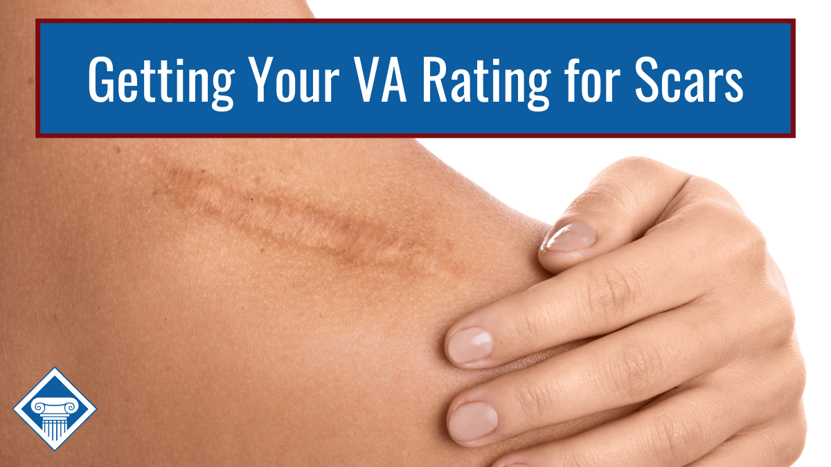 Getting your VA rating for scars can be tricky. Learn how it works.