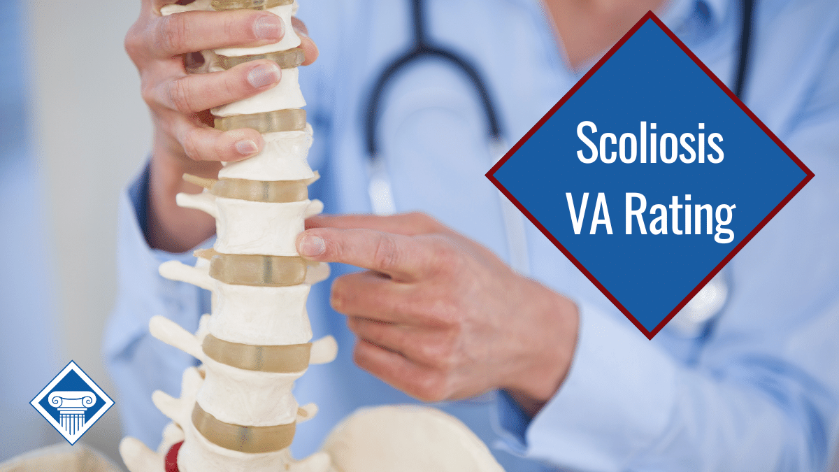 Scoliosis VA Rating