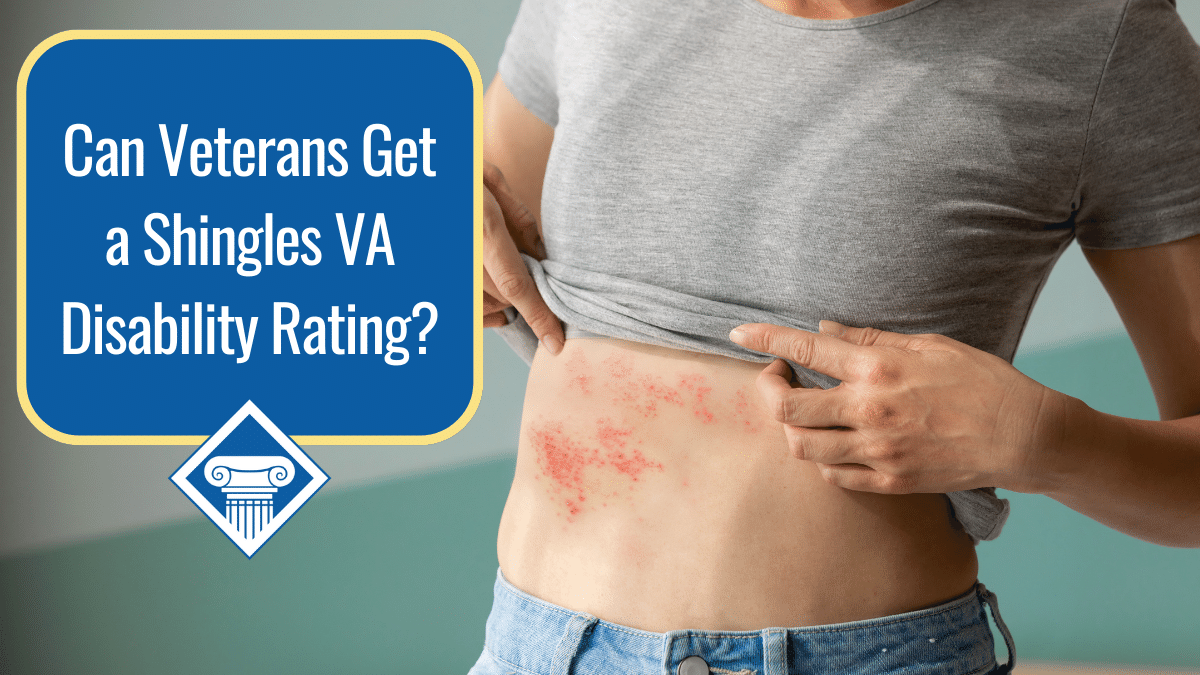 Can veterans get a shingles VA disability rating?