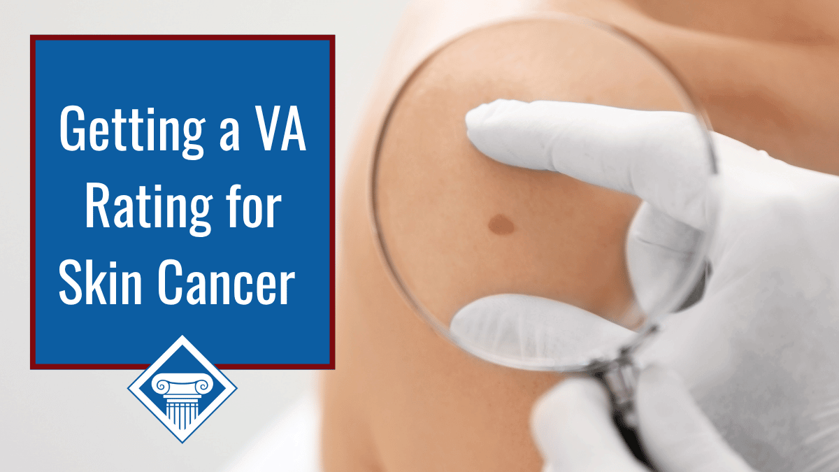 Getting a VA rating for skin cancer